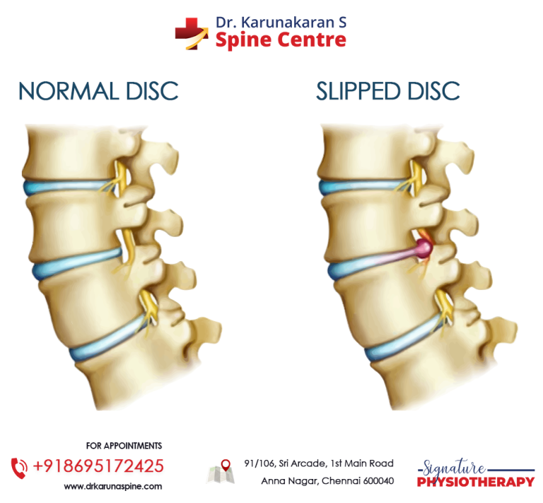 Best Spine Specialist In Chennai | Dr Karunakaran Spine Centre