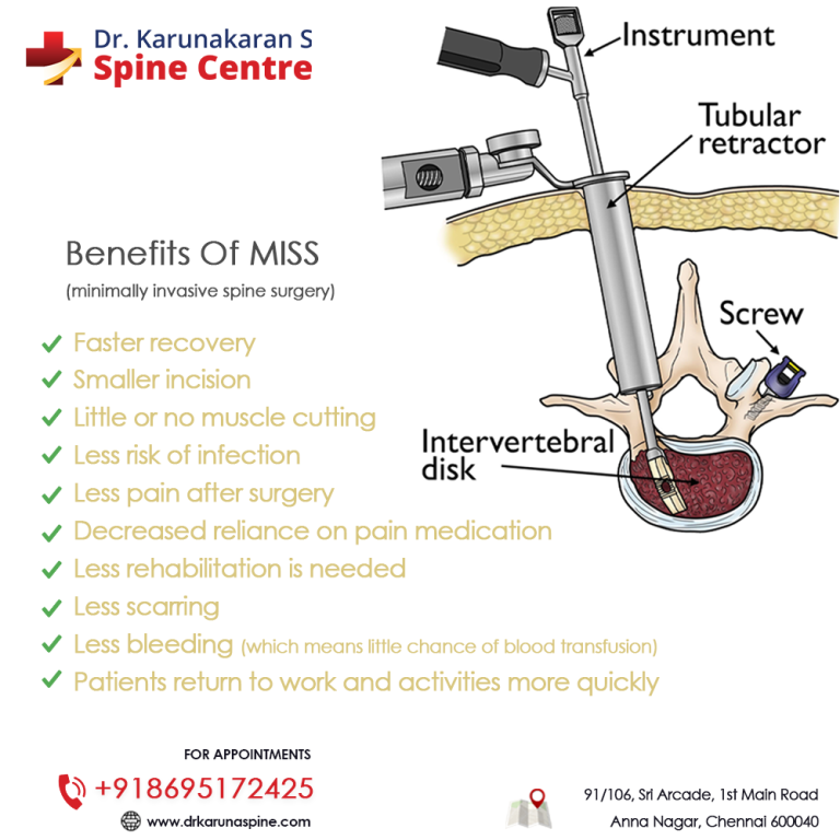 Open surgery vs. Minimally invasive spinal surgery – Best Spine ...